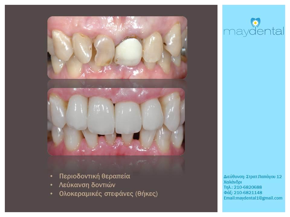 Maydental, Οδοντίατρος, Περιοδοντολόγος Χαλάνδρι σε Χαλάνδρι ...